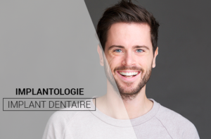 Dentiste pas cher, Paris - Dr Sebban - Implant dentaire Paris